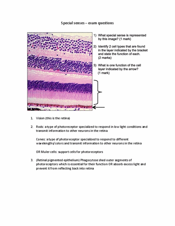 BIOM 4070 Study Guide - Fall 2016, Final - Special Senses, Retina ...